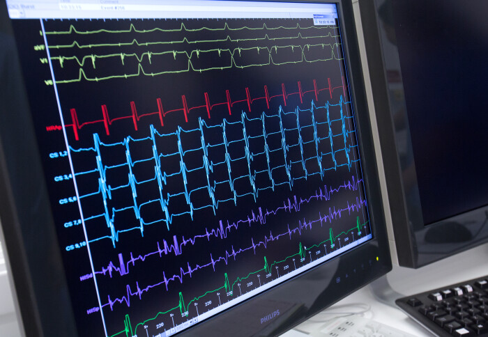 El modelo de IA lee los ECG para identificar a las pacientes femeninas ...